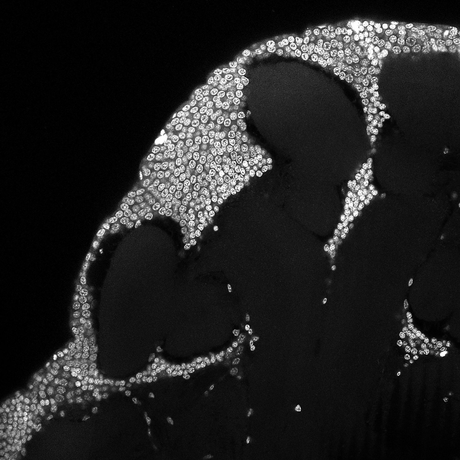 Ant brains: marvelous atoms of matter – Myrmecological News Blog